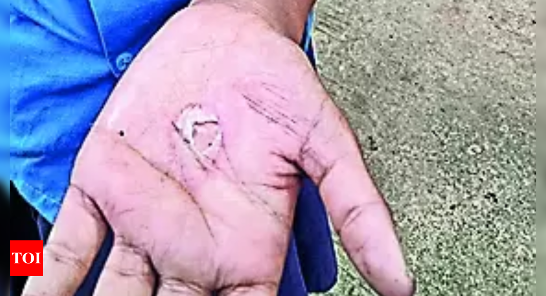 Headmistress Teachers Punish Girls With Hot Oil Suspended Punjab